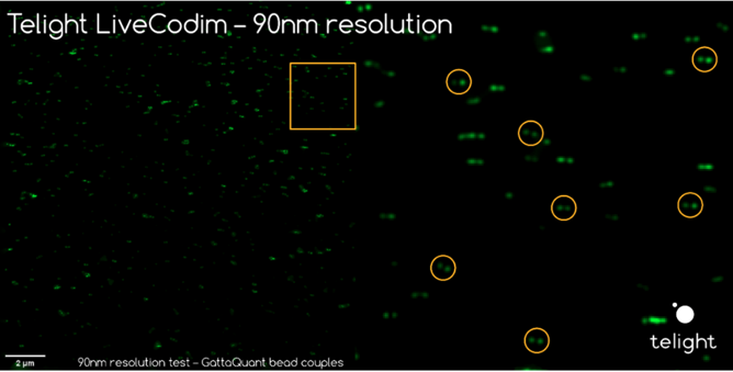 LiveCodim de Telight alcanza 90nm de resolución en imágenes de fluorescencia | Izasa Scientific